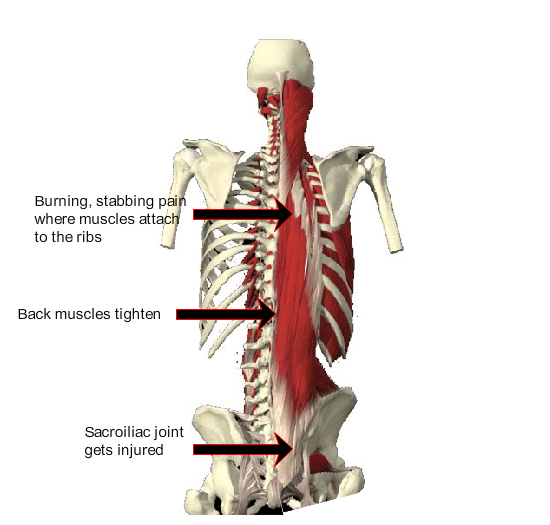 Mid and Low Back Pain - North Oakland Chiropractic Clinic